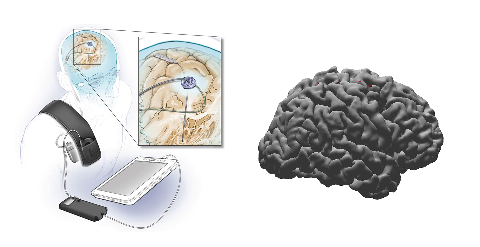 Motor Sequence Learning Wang Lab Unraveling Circuit Dynamics Of